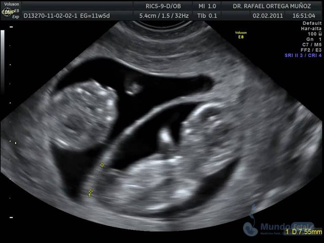 Mundo Fetal