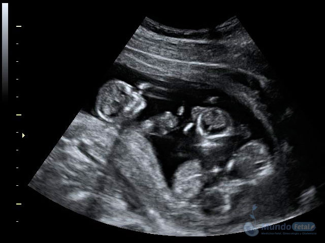 Mundo Fetal