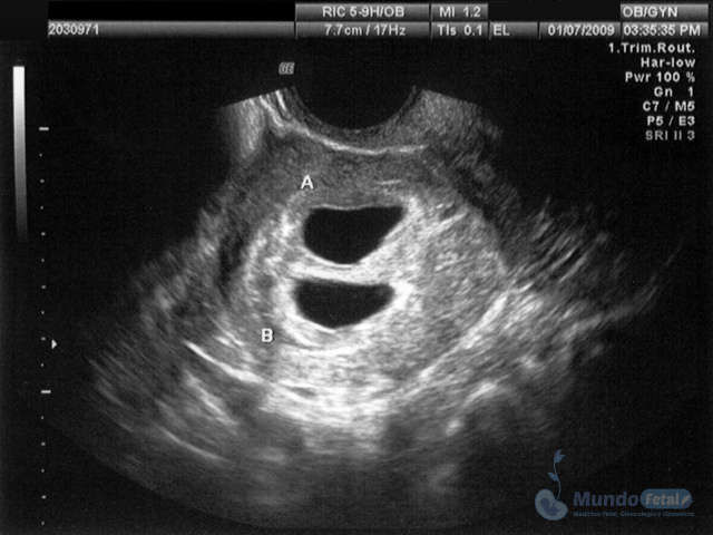Mundo Fetal