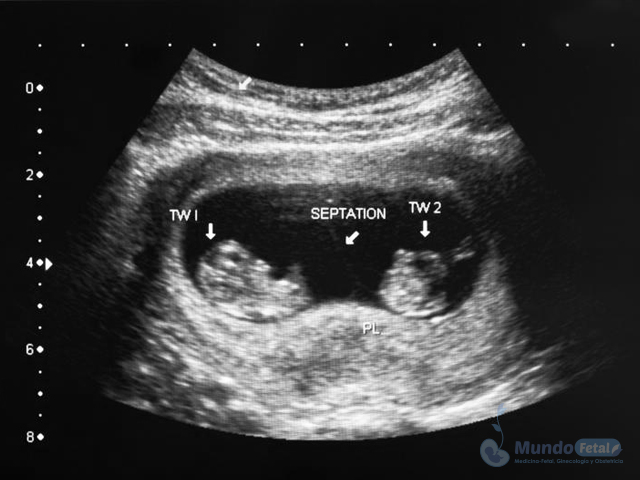 Mundo Fetal